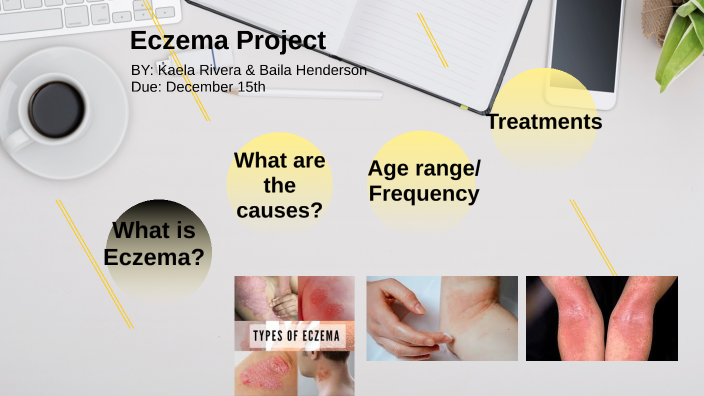 Eczema Project by Kaela Rivera on Prezi