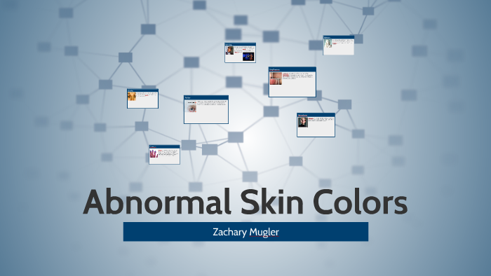 Abnormal Skin Colors by zac mugler on Prezi