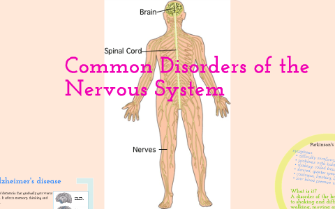 The Nervous System by Alana Sweeney