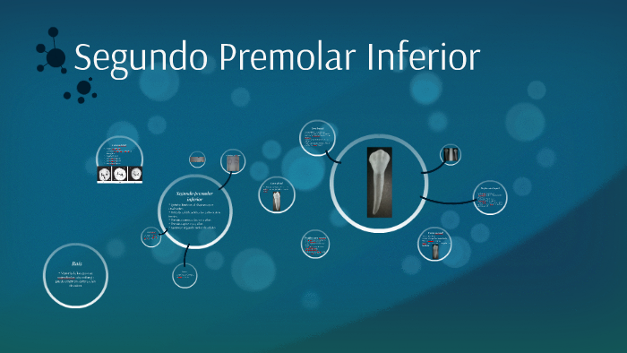 Segundo Premolar Inferior by Julieta Rosas Hernandez on Prezi
