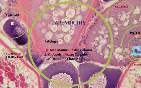 APENDICITIS by Jocelyn Salgado on Prezi
