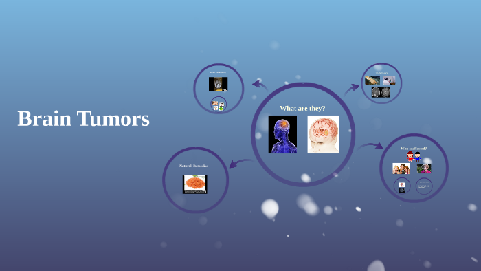 Brain Tumors by Ellie Hopkins