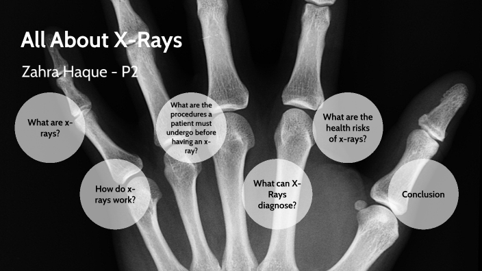 X-Rays - Zahra Haque by Zahra Haque on Prezi