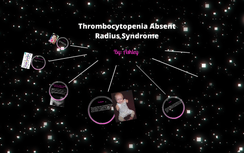 Thrombocytopenia Absent Radius Syndrome by Ashley Roberson on Prezi