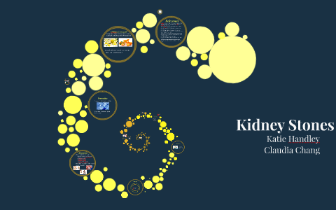 Kidney Stones by Katie Handley on Prezi