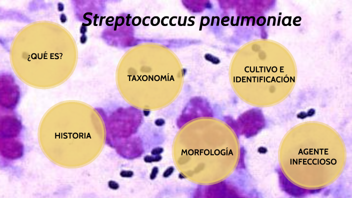 Neumococo by Nadia P. on Prezi