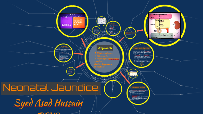 Neonatal Jaundice by Syed Hussain on Prezi
