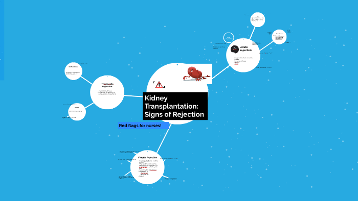 Kidney Transplantation: Signs of Rejection by Jacqueline Harris on Prezi