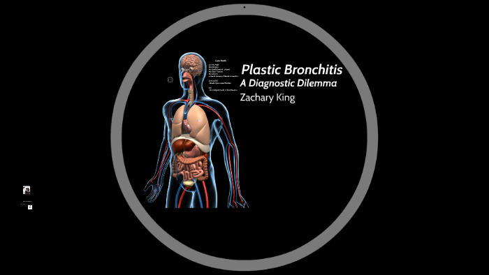 Plastic Bronchitis by Zachary King on Prezi