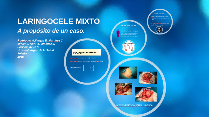LARINGOCELE MIXTO by Adriana Rodriguez on Prezi