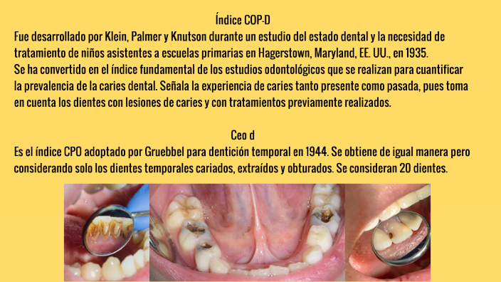 índices de caries ceo-d, COD, by jeisson Garzon Baquero on Prezi