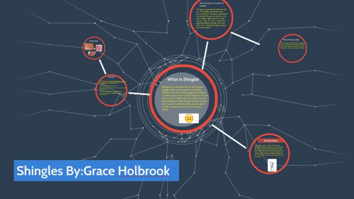 Shingles by Grace Holbrook