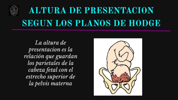 ALTURA DE PRESENTACIÓN FETAL SEGÚN LOS PLANOS DE HODGE by Gabriela ...