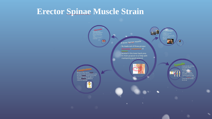 Erector Spinae Muscle Strain by Tony Nguyen on Prezi