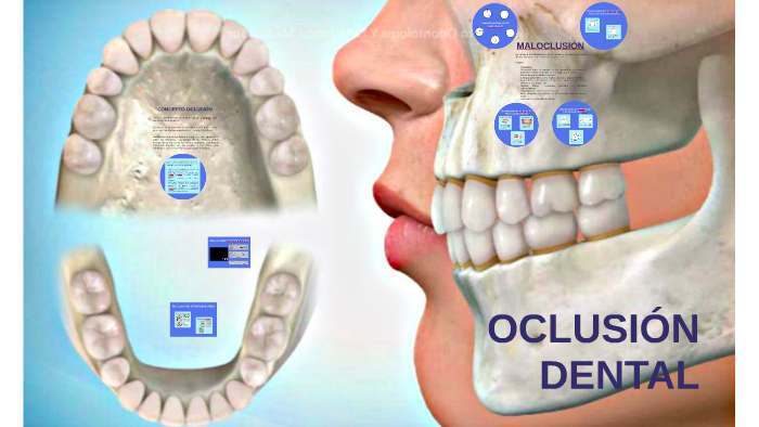 OCLUSIÓN DENTAL by on Prezi