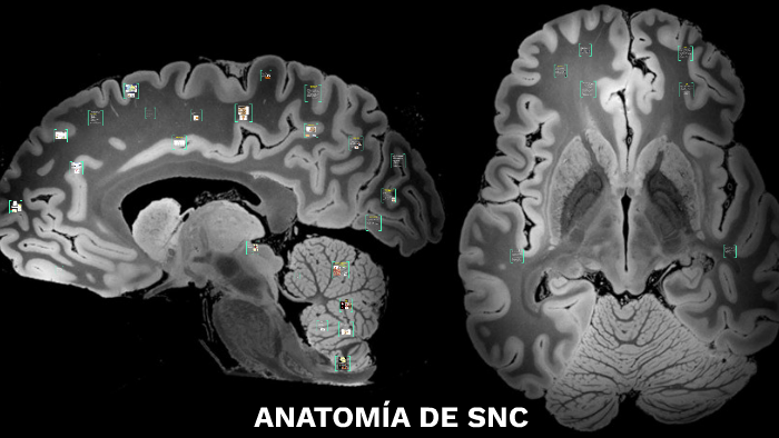 ANATOMÍA DE SNC by Maira Fernandez on Prezi