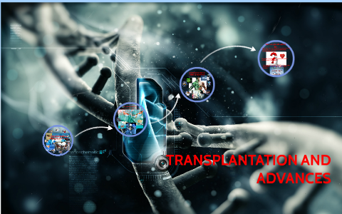 ADVANCES IN TRANSPLANTATION by Joel Gonzalez on Prezi