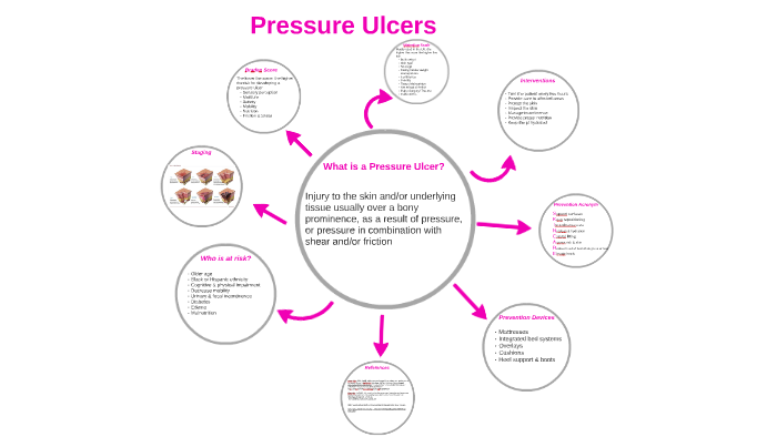 Pressure Ulcers by on Prezi