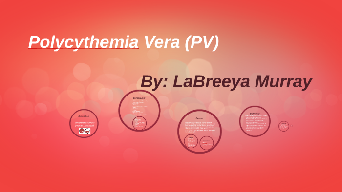 Polycythemia Vera by LaBreeya Murray on Prezi