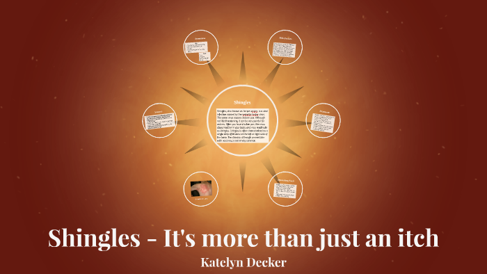 Shingles by Katelyn Decker on Prezi