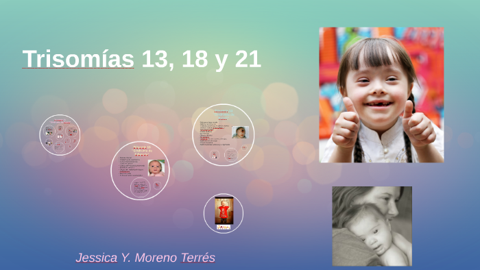 Trisomías 13, 18 y 21 by Jessica Y. Moreno Terres on Prezi