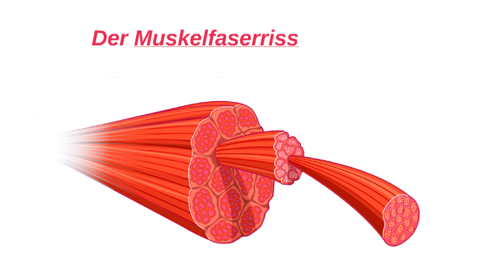 Der Muskelfaserriss by M S on Prezi