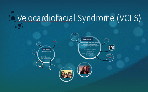 Velocardiofacial Syndrome by Rebecca Weber on Prezi