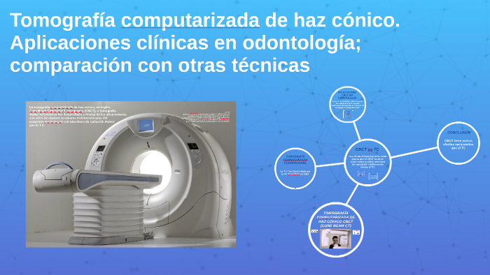Tomografía Computerizada De Haz Cónico By Jose Cantillano On Prezi