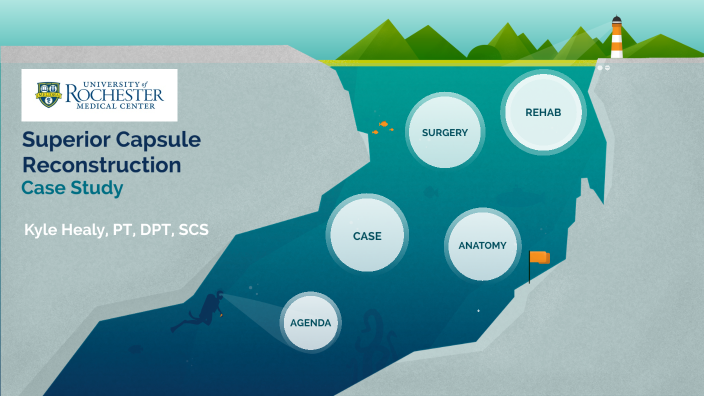 Superior Capsule Reconstruction - Case Study by Kyle Healy on Prezi