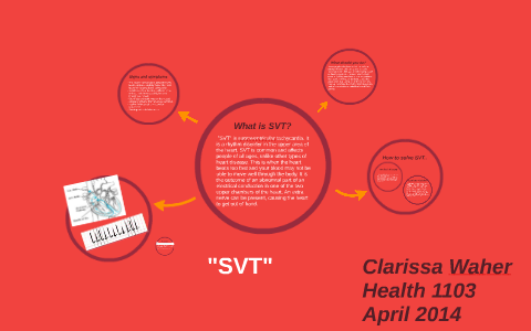 "SVT" stands for supraventricular tachycardia. It is a rhyth by ...