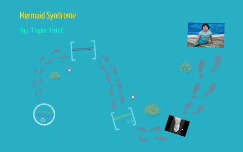 Mermaid Syndrome by Taylor Heldt on Prezi
