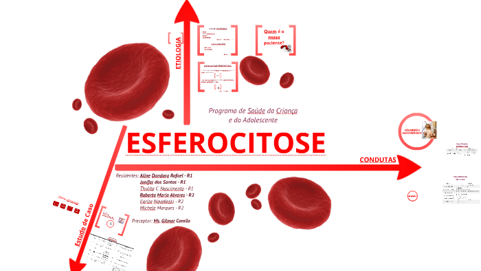 ESFEROCITOSE_ ATENDIMENTO FISIOTERAPEUTICO by jenifer santos on Prezi