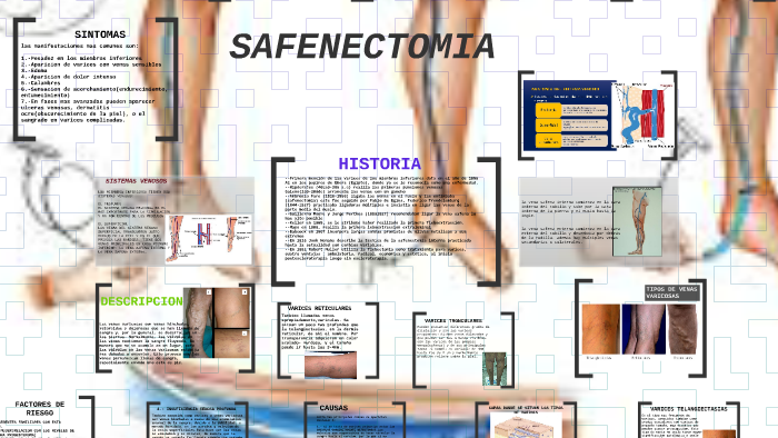 SAFENECTOMIA by Yogito Contreras on Prezi