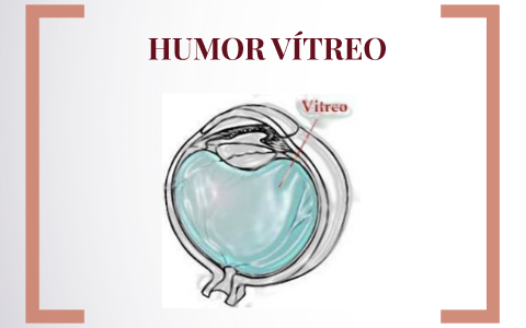 HUMOR VÍTREO by vanessa Rincon on Prezi