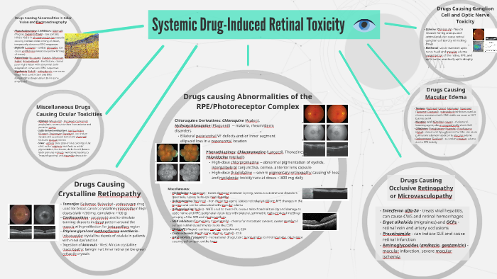 Systemic Drug-Induced Retinal Toxicity by Sally Baxter on Prezi