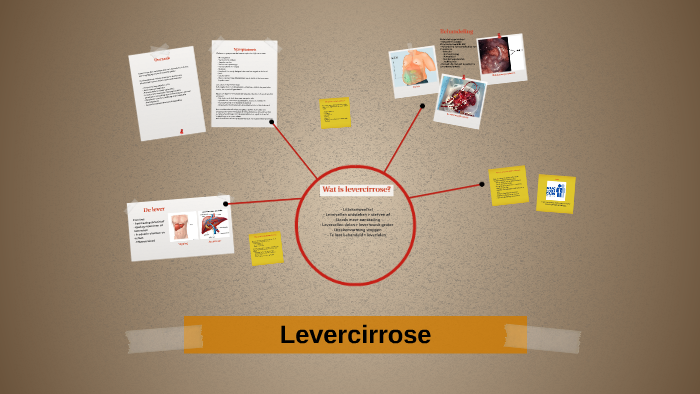 Wat is levercirrose? by Noreen van Hoof on Prezi