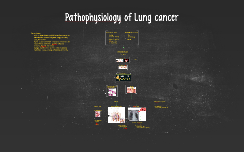 Pathophysiology of Lung cancer by gabriel stephen on Prezi