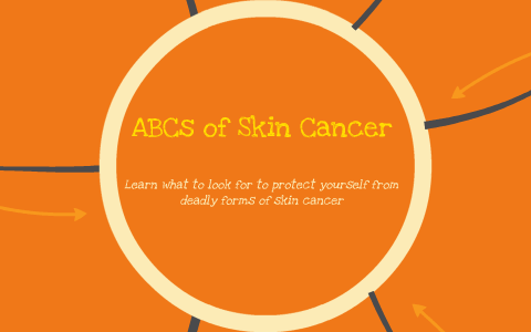 ABCs of Skin Cancer by Emily Spinos on Prezi