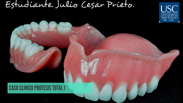 CASO CLINICO PROTESIS TOTAL I by julio cesar prieto bermudez on Prezi