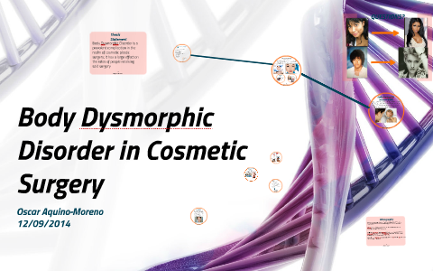 Body Dysmorphic Disorder in Cosmetic Surgery by Oscar Aquino-Moreno on ...