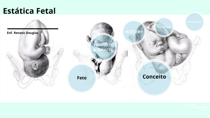 Estática Fetal by Renato Souza on Prezi
