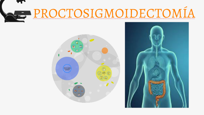 PROCTOSIGMOIDECTOMÍA by maria camila rangel gomez on Prezi