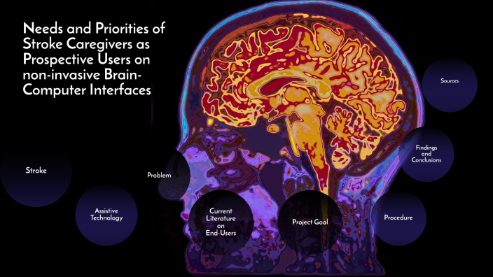 Brain Computer Interface for Stroke by Ezequiel Bautista on Prezi