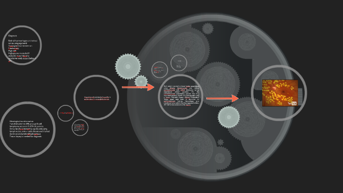 Hyperviscosity related retinopathy in waldenstrom's macroglo by LESLY ...