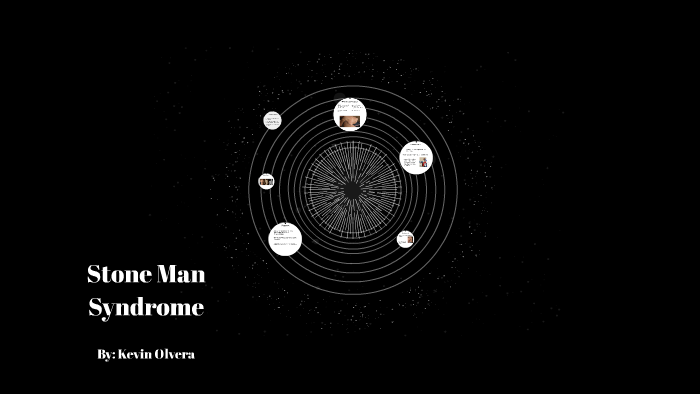 Stone Man Syndrome by Kevin Olvera on Prezi