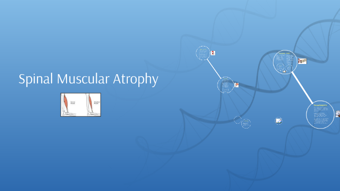 Spinal Muscular Atrophy 2nd by Brian Neer on Prezi