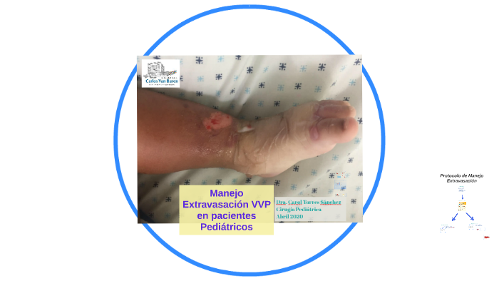 ¿Qué es extravasación? by Carol Torres Sanchez on Prezi