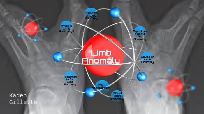 Limb Anomaly by Kaden Gillette on Prezi