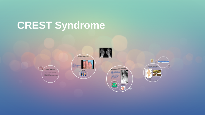 CREST syndrome by Lucy Cheng on Prezi