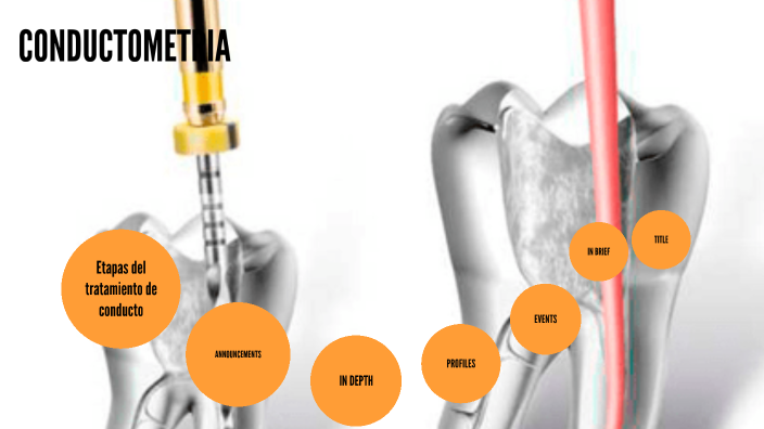 conductometria by Raquel Rosas on Prezi